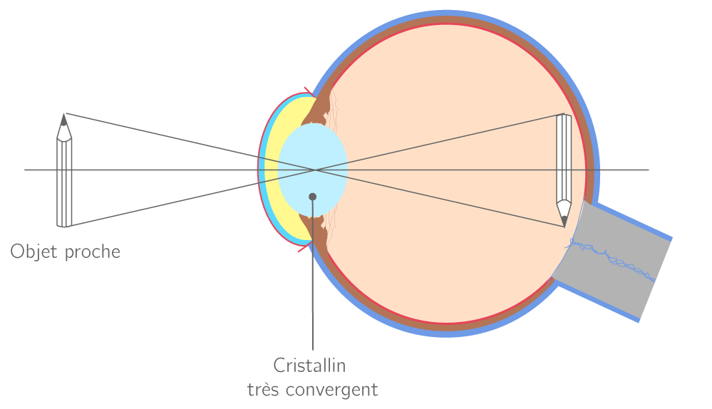 Kartable | 1ère S : Physique-Chimie - Cours : La vision et l'image